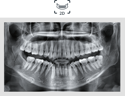 Smart 8×8 Scan Ceph – Panoramique 3D Céphalo VATECH – Synergy Dental